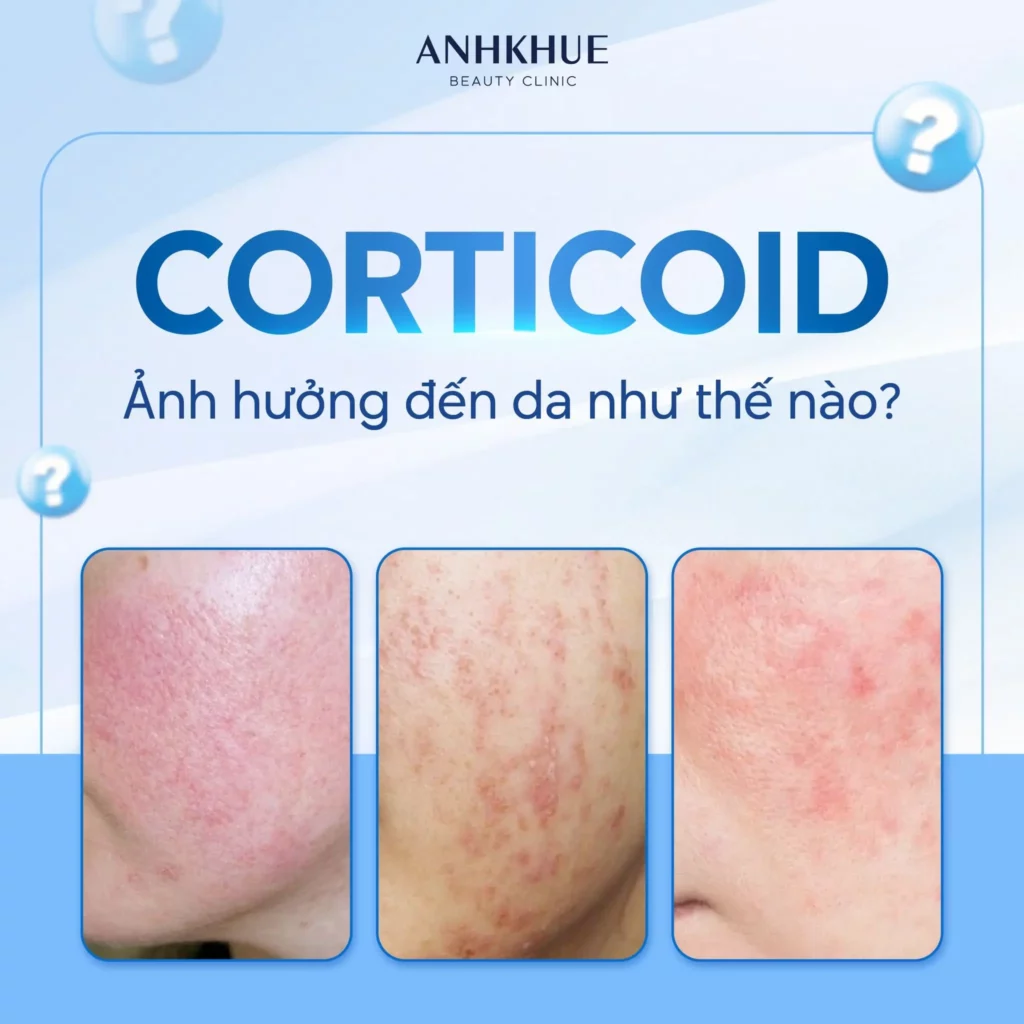 Những sự thật đáng sợ về mỹ phẩm chứa Corticoid không rõ nguồn gốc ...
